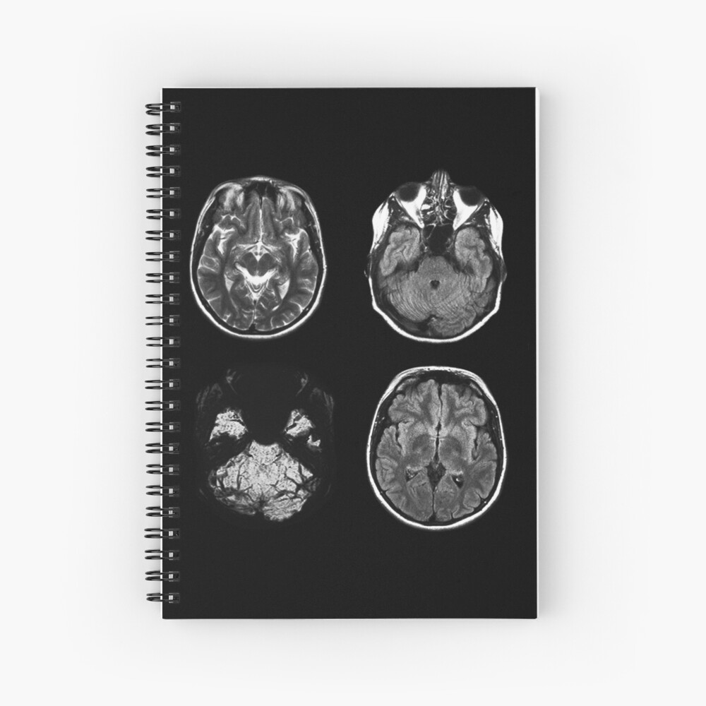 "Brain MRI x-ray" Spiral Notebook for Sale by gmstockstudio | Redbubble