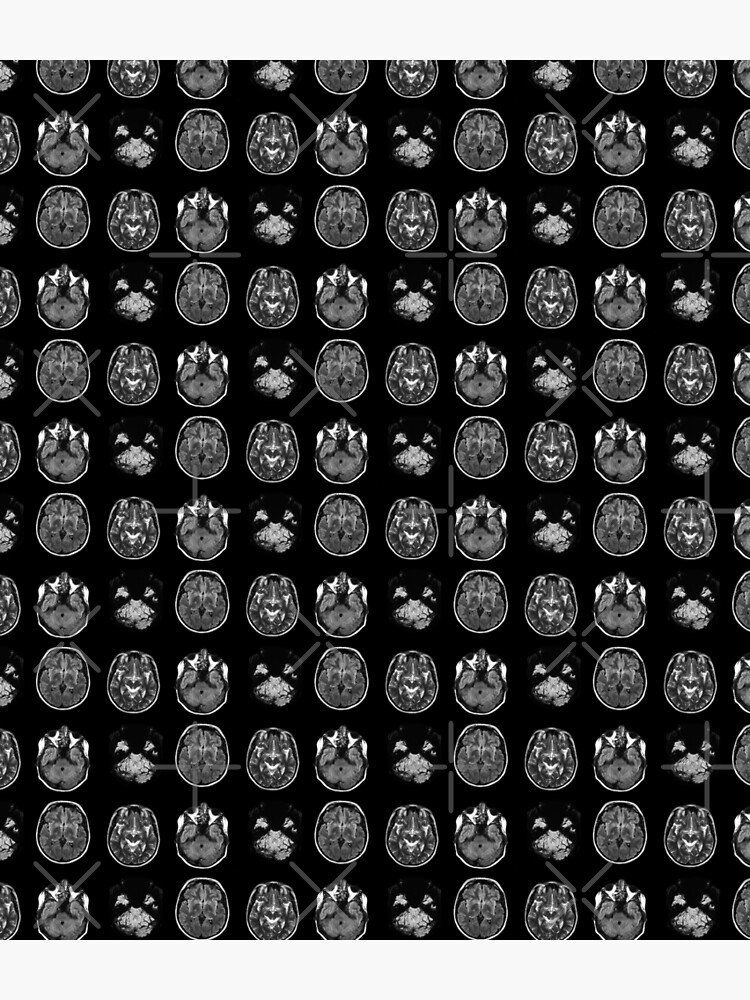 Brain MRI x-ray Backpack sold by DanieFischer | SKU 40968627 | Printerval