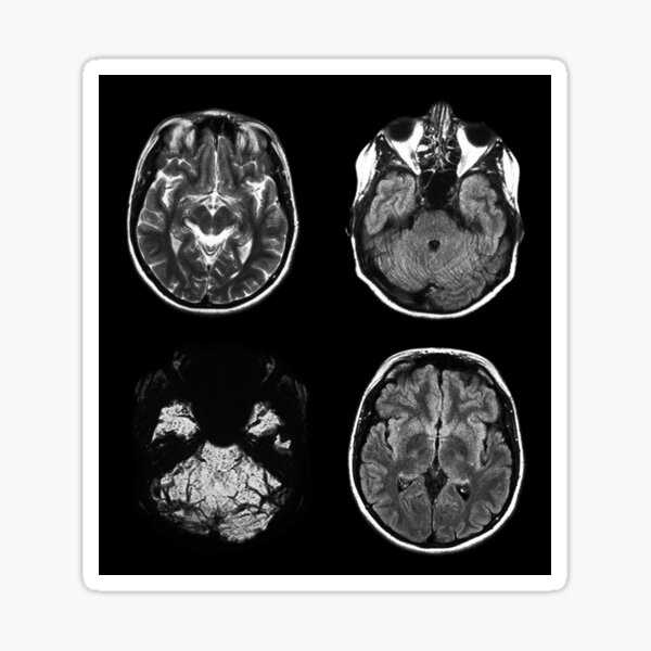 "Brain MRI x-ray" Sticker for Sale by gmstockstudio | Redbubble