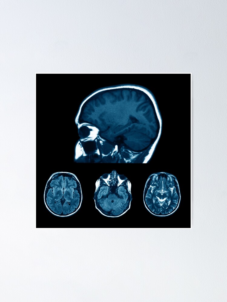 "Brain MRI x-ray" Poster for Sale by gmstockstudio | Redbubble