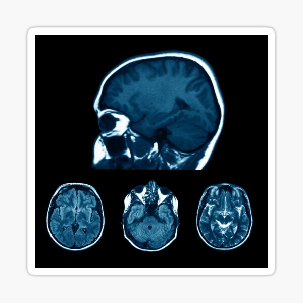 "Brain MRI x-ray" Sticker for Sale by gmstockstudio | Redbubble