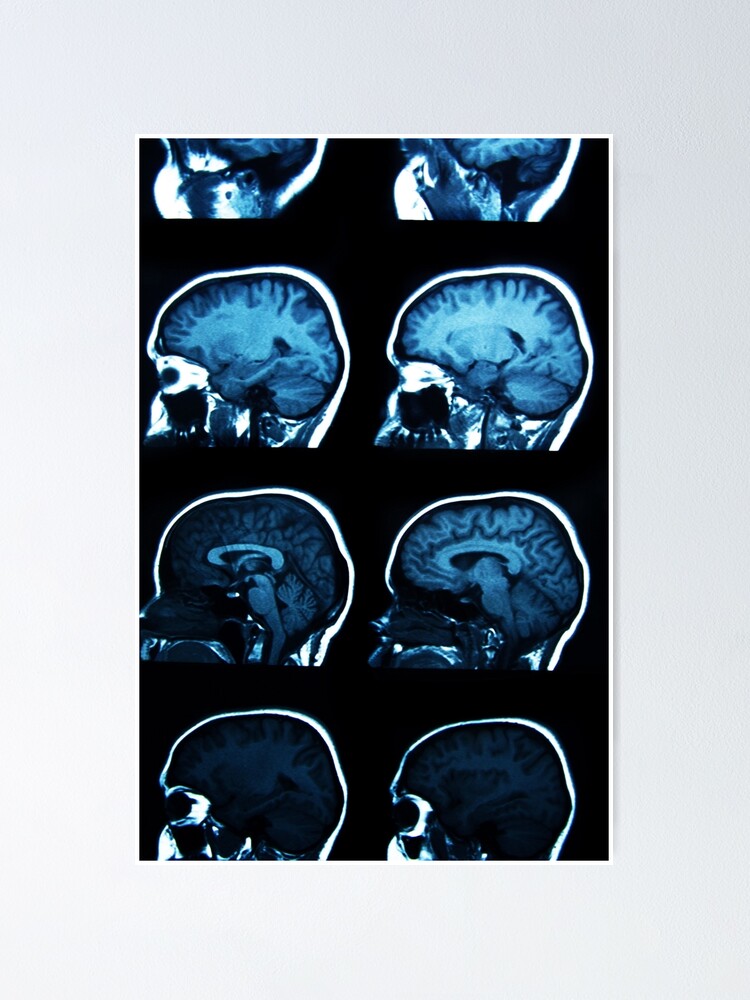 "Brain MRI x-ray" Poster for Sale by gmstockstudio | Redbubble