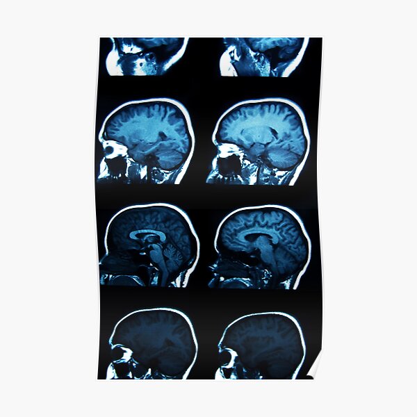 "Brain MRI x-ray" Poster for Sale by gmstockstudio | Redbubble