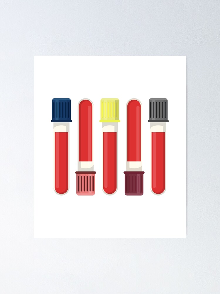 "Test Tubes - Medical Laboratory Science - Medical Laboratory ...