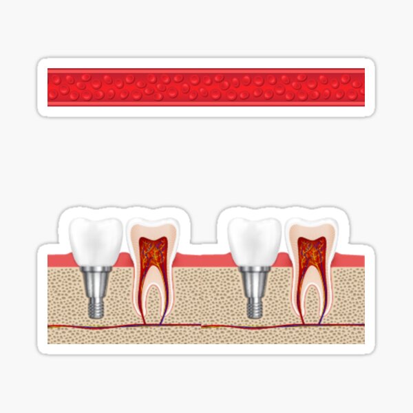 "Tooth Anatomy Implant Specialist Gift Idea Teeth Dental Assistant ...
