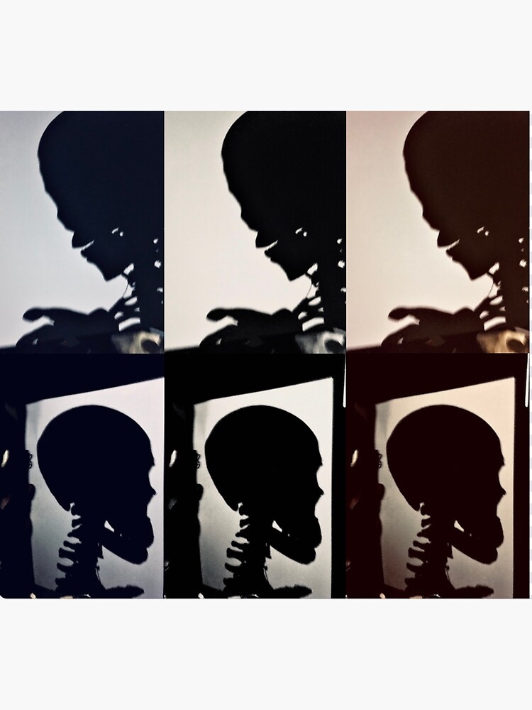 "skeleton shadow photography collection " Sticker for Sale by Talies ...