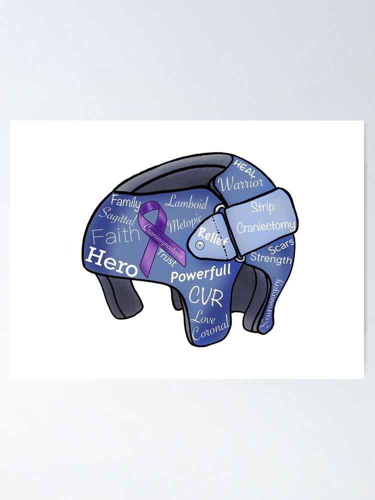 "Craniosynostosis Heroes wear Helmets" Poster for Sale by CandiOldfield ...