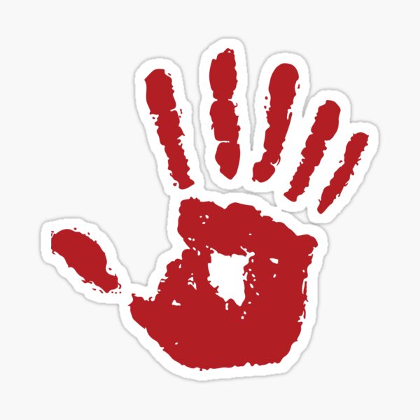 "Hand with 6 fingers - 3rd type 6 fingers hand, we know" Sticker for ...