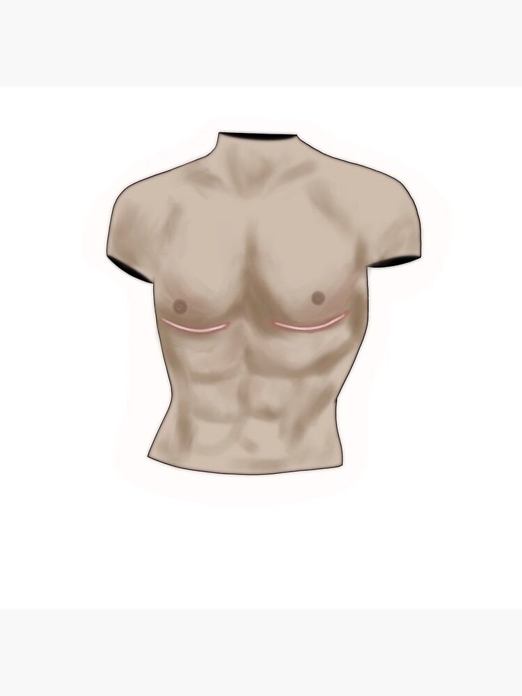 "Top Surgery Scars [SHADE 02]" Sticker by AshesOfArt | Redbubble