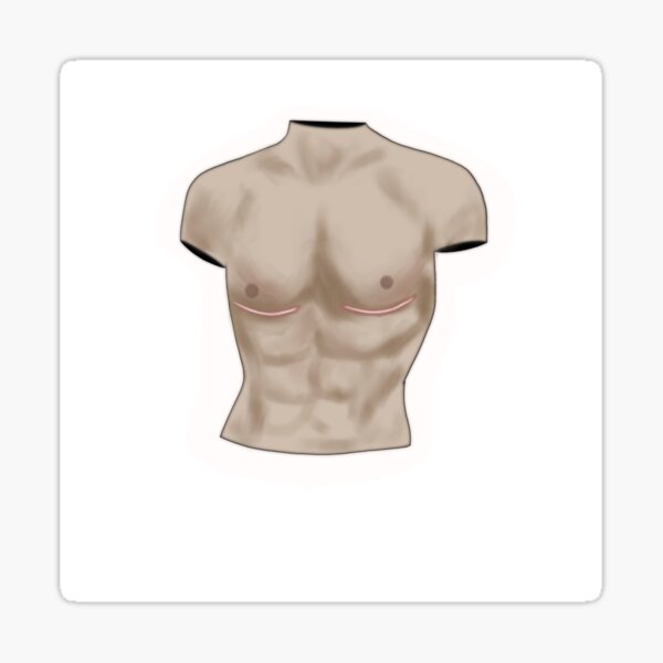 "Top Surgery Scars [SHADE 02]" Sticker by AshesOfArt | Redbubble