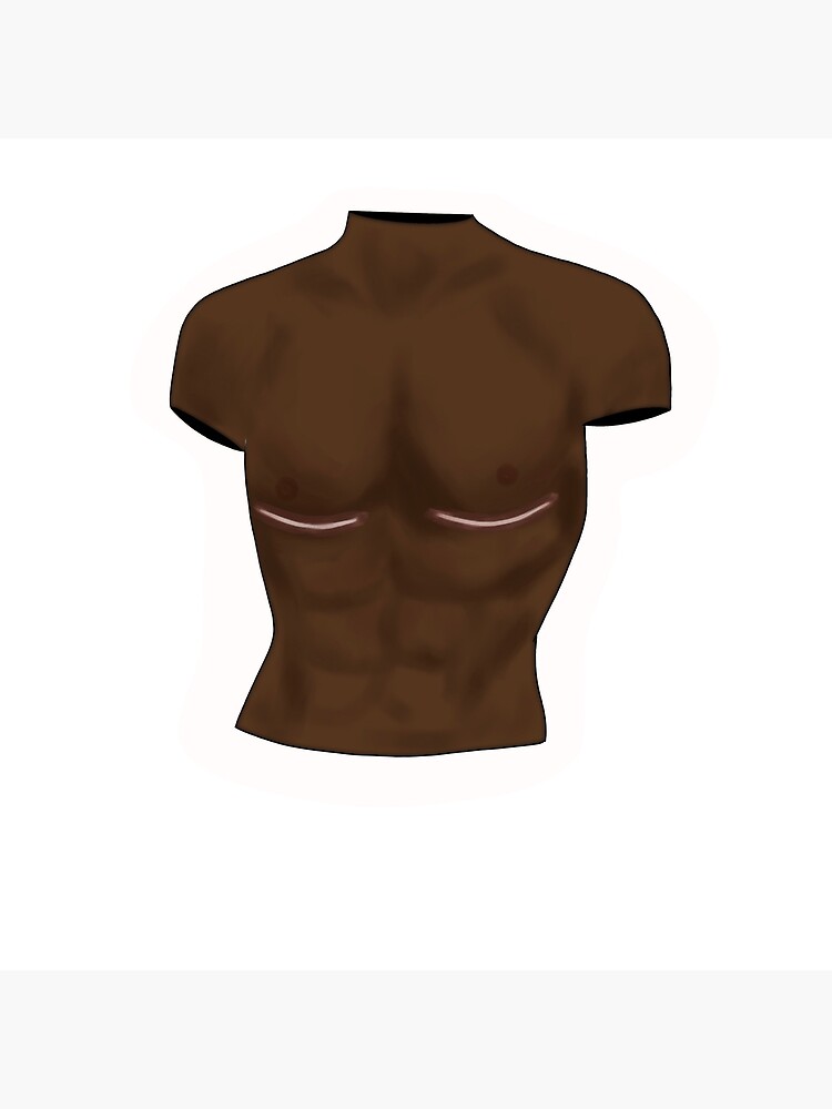 "Top Surgery Scars [SHADE 05]" Poster for Sale by AshesOfArt | Redbubble