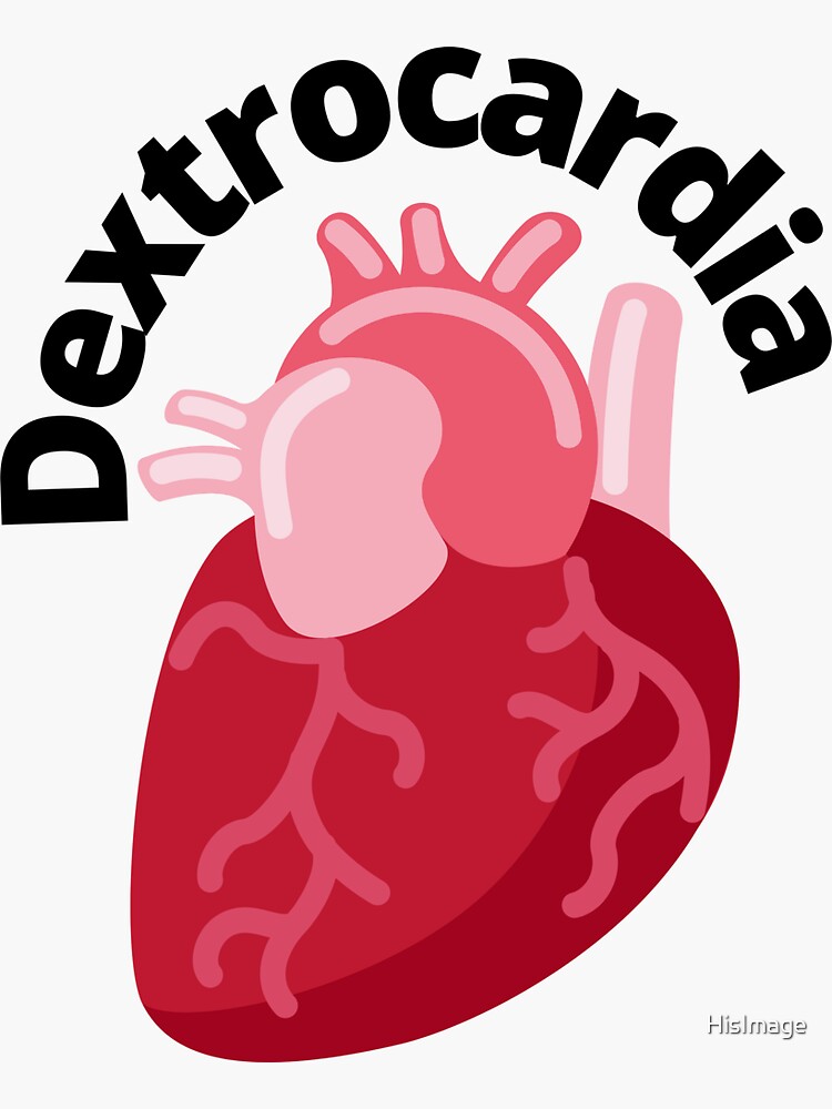 "Dextrocardia, Dextrocardia meaning, Dextrocardia awareness ...