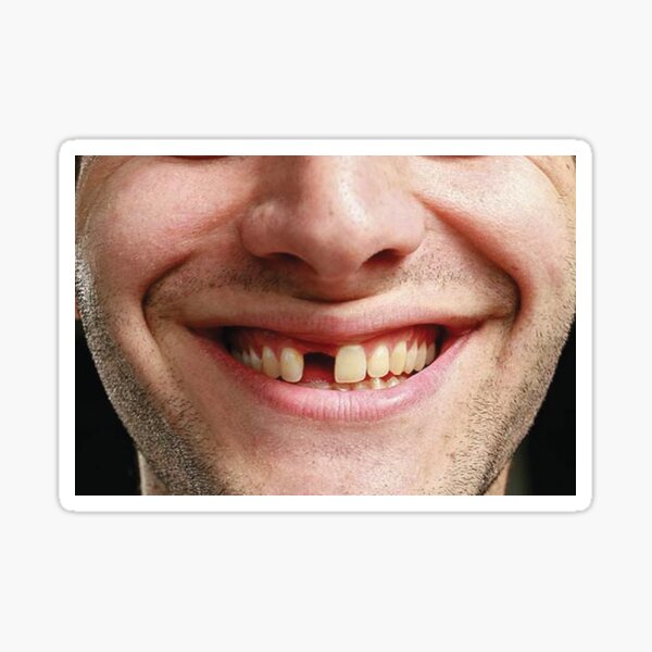 "Funny Missing Teeth men smile for smiling face Mask" Sticker for Sale ...