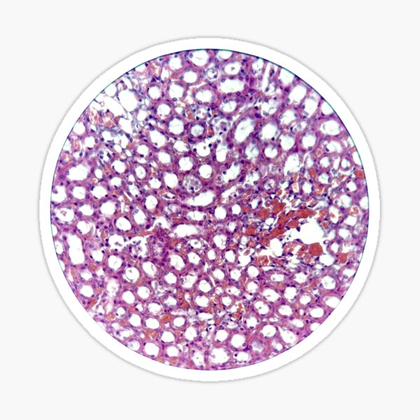 "Bone Marrow" Sticker for Sale by Hemistra | Redbubble