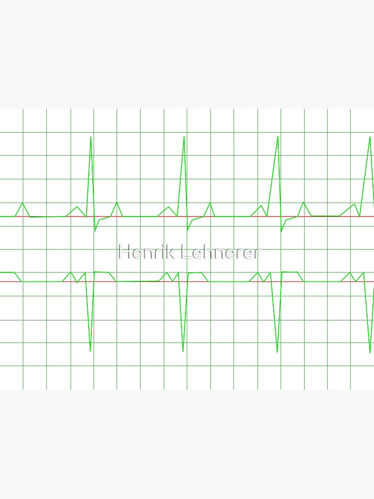 "Normal Heart Rhythm" Sticker for Sale by hlehnerer | Redbubble