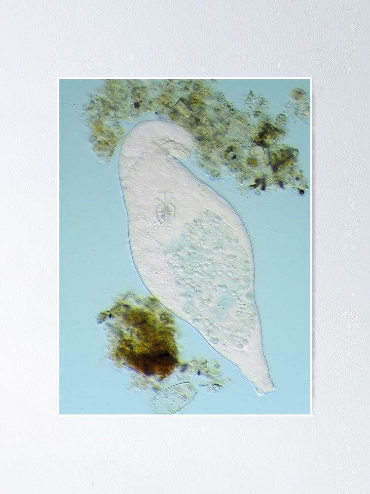 "Bdelloid rotifer under the microscope" Poster for Sale by sdymchenko ...