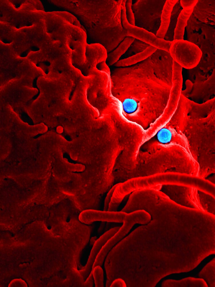 "Blood clot monster or red coral reef" Sticker for Sale by AvasMix ...