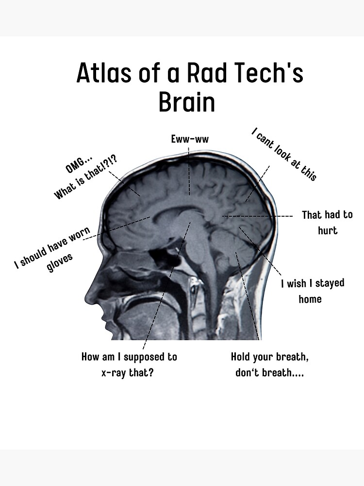 "Anatomy of a Rad Techs Brain" Poster for Sale by RadRaysShop | Redbubble