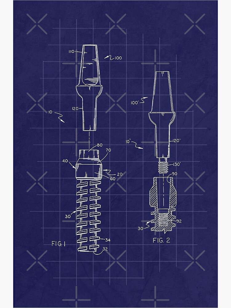 "blueprint implant, patent, technical drawing, dentist, dental ...