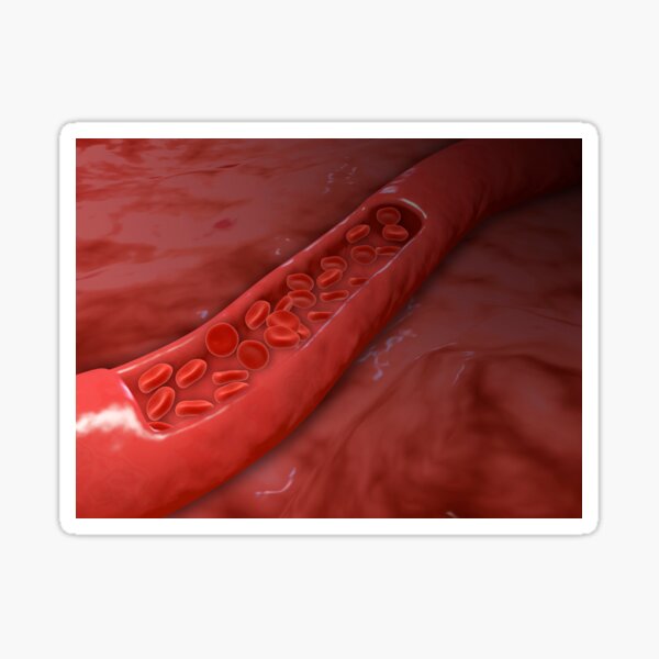 "Artery cross section with red blood cell flow." Sticker for Sale by ...