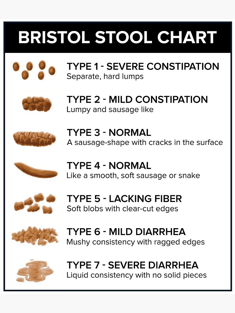 "Bristol stool chart" Art Print for Sale by Glinda-39 | Redbubble