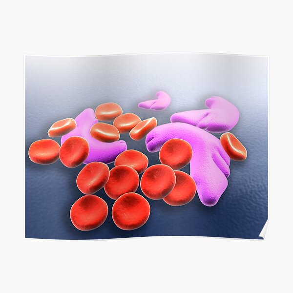 "Conceptual image of sickle cell anemia." Poster by StocktrekImages ...
