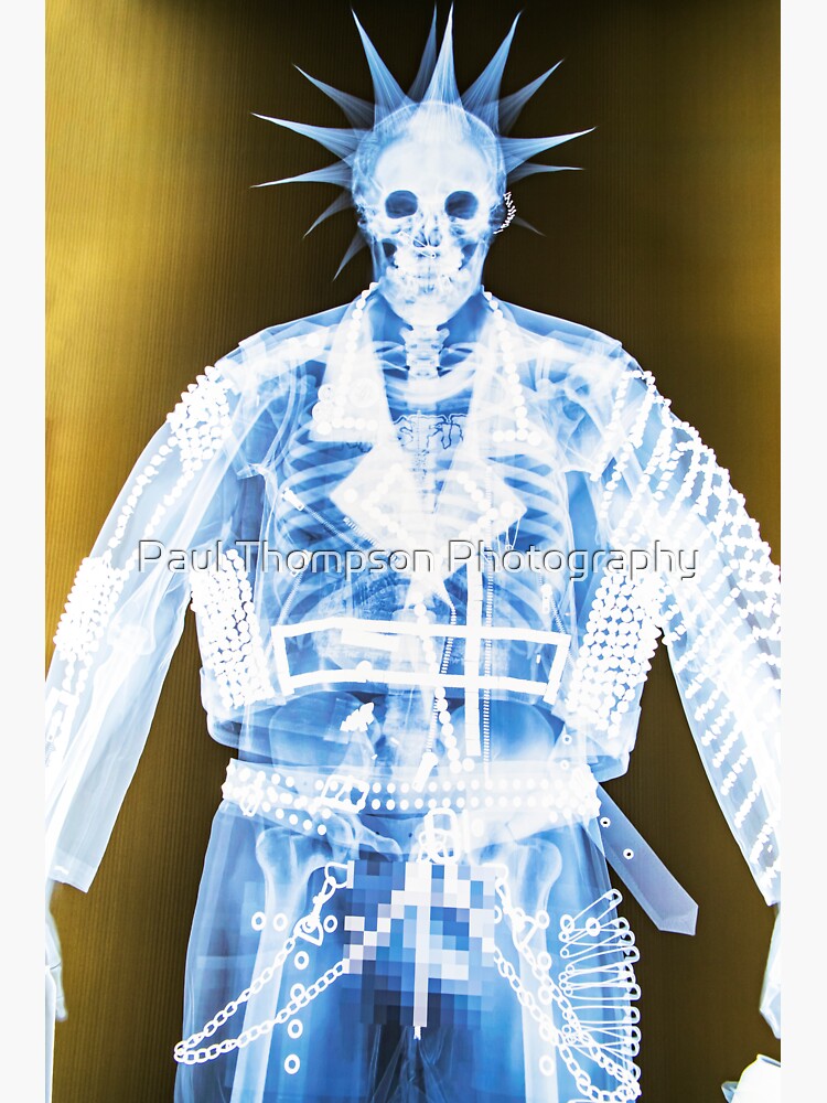"Punk Rock X-ray" Sticker for Sale by tommysphotos | Redbubble