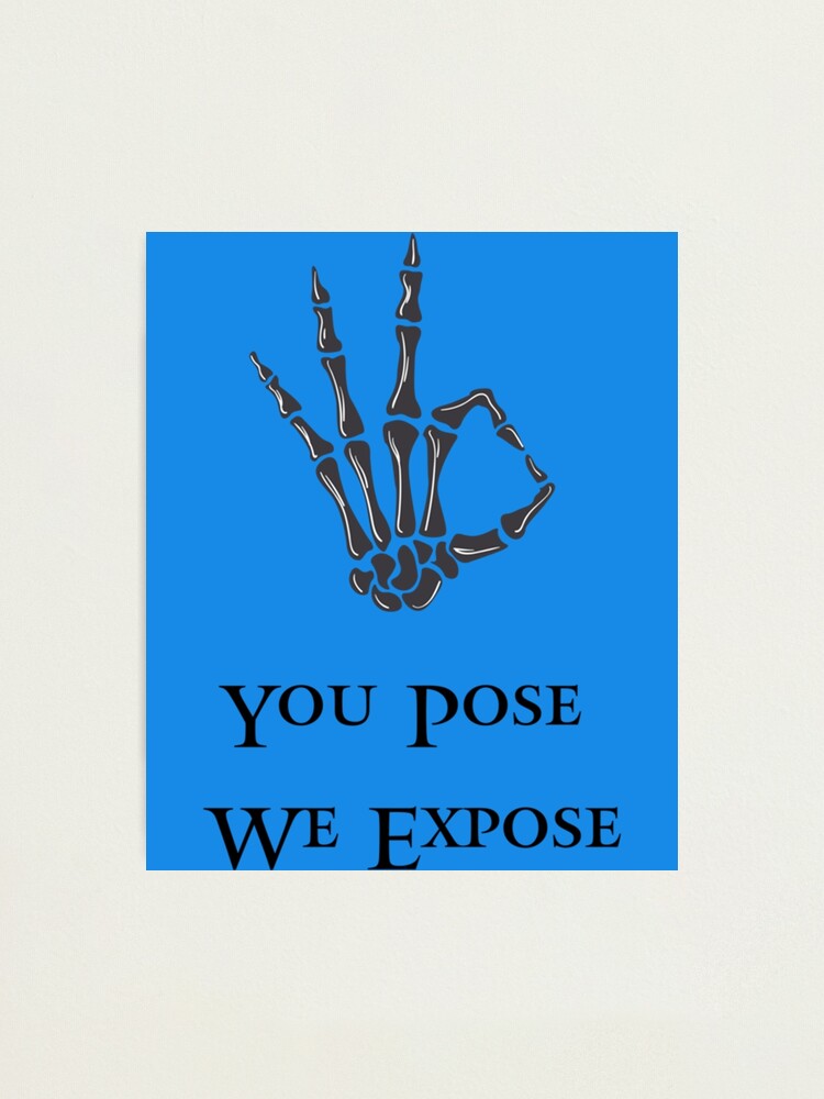 "Funny Radiology You Pose We Expose Dabbing Skeleton X-Ray ...