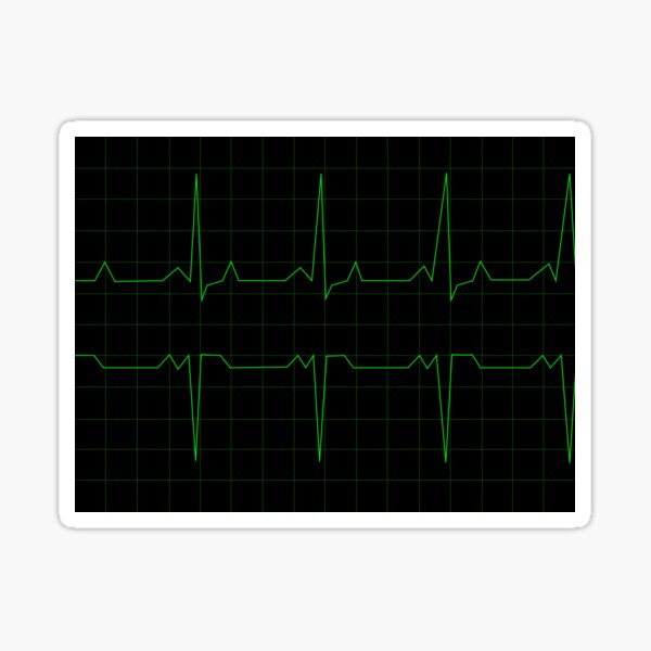 "Normal Heart Rhythm" Sticker for Sale by hlehnerer | Redbubble