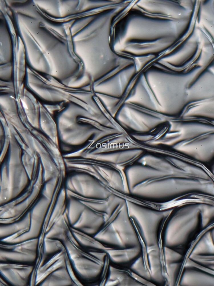 "Fibers of Cellulose acetate under the microscope." iPhone Case for ...
