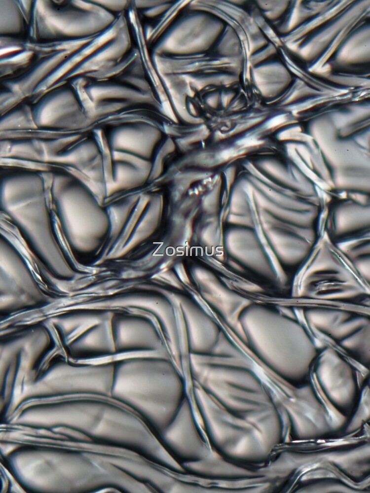 "Fibers of Cellulose acetate under the microscope." iPhone Case for ...