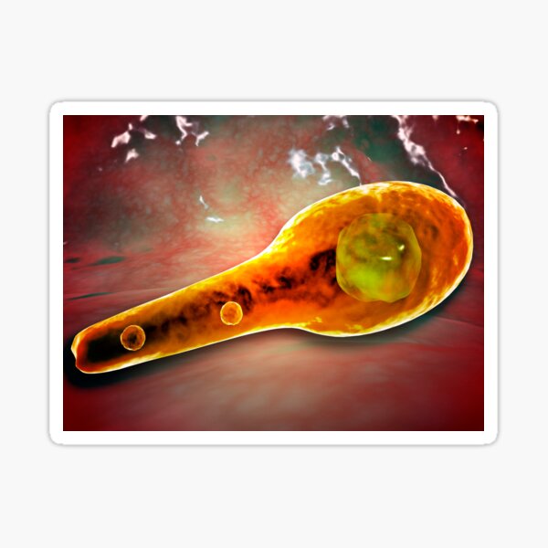 "Microscopic view of Tetanus." Sticker for Sale by StocktrekImages ...