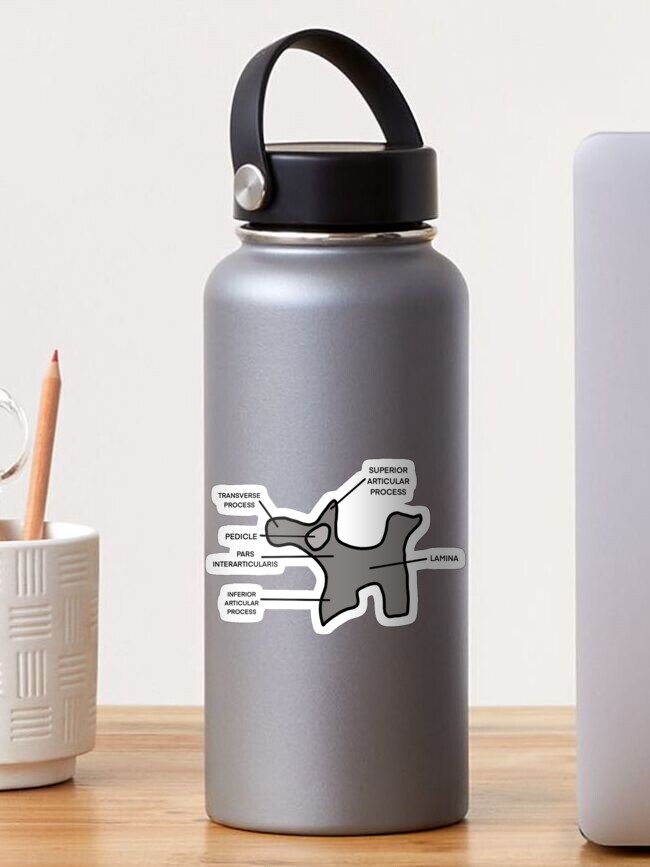 "Scotty Dog Labeled" Sticker for Sale by RadTechRiegel | Redbubble