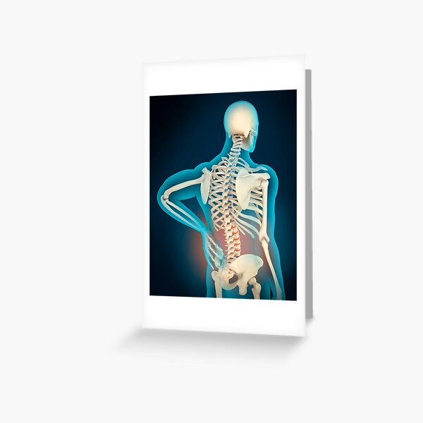 Medical Illustration Showing Inflammation In Human Back Area Greeting medical-illustration-showing-inflammation-in-human-back-area-greeting