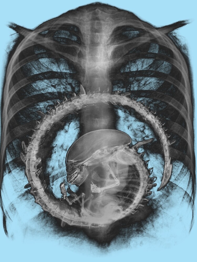 "Alien radiography v2, Alien X-ray v2 Classic T-Shirt" Art Print for ...