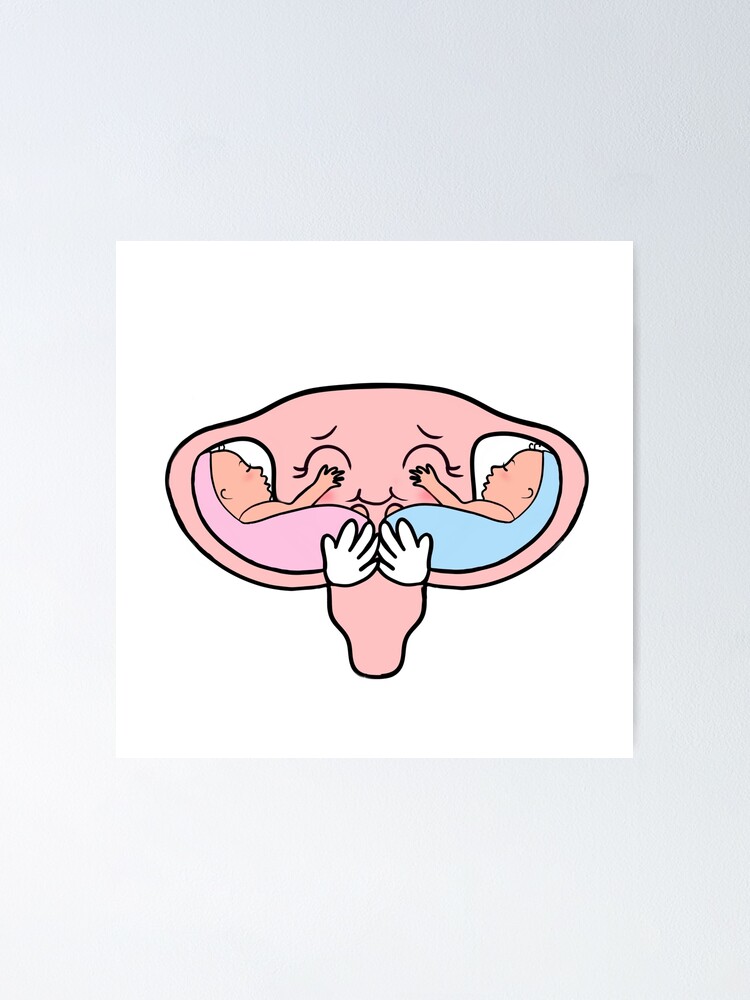Pregnant Uterus With Twins Poster For Sale By Mermaidssparkle Redbubble