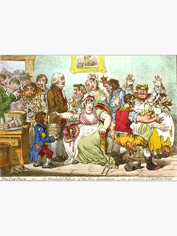 "The Cow Pock caricatured by James Gillray in the 17th Century" Poster ...