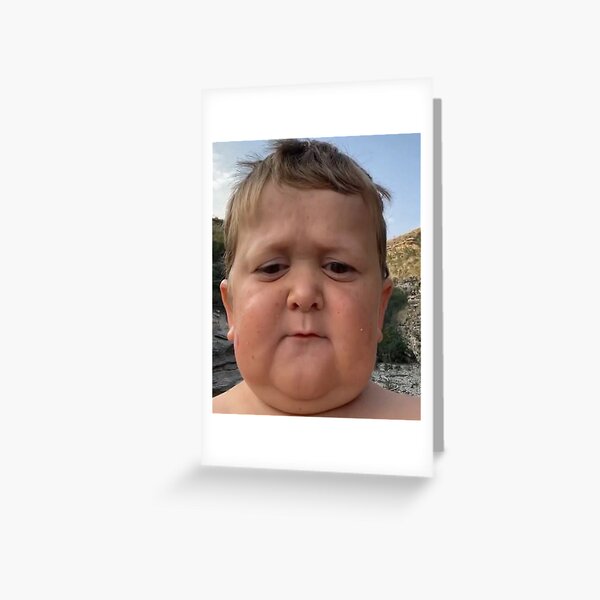 "Hasbulla - Funny Hasbulla Hasbullah smile - Team MMA Hasbulla ...