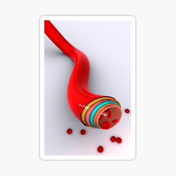 "Conceptual image of a blood vessel." Sticker for Sale by ...