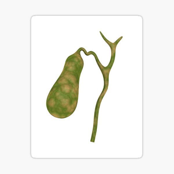 "Conceptual image of human gall bladder." Sticker for Sale by ...