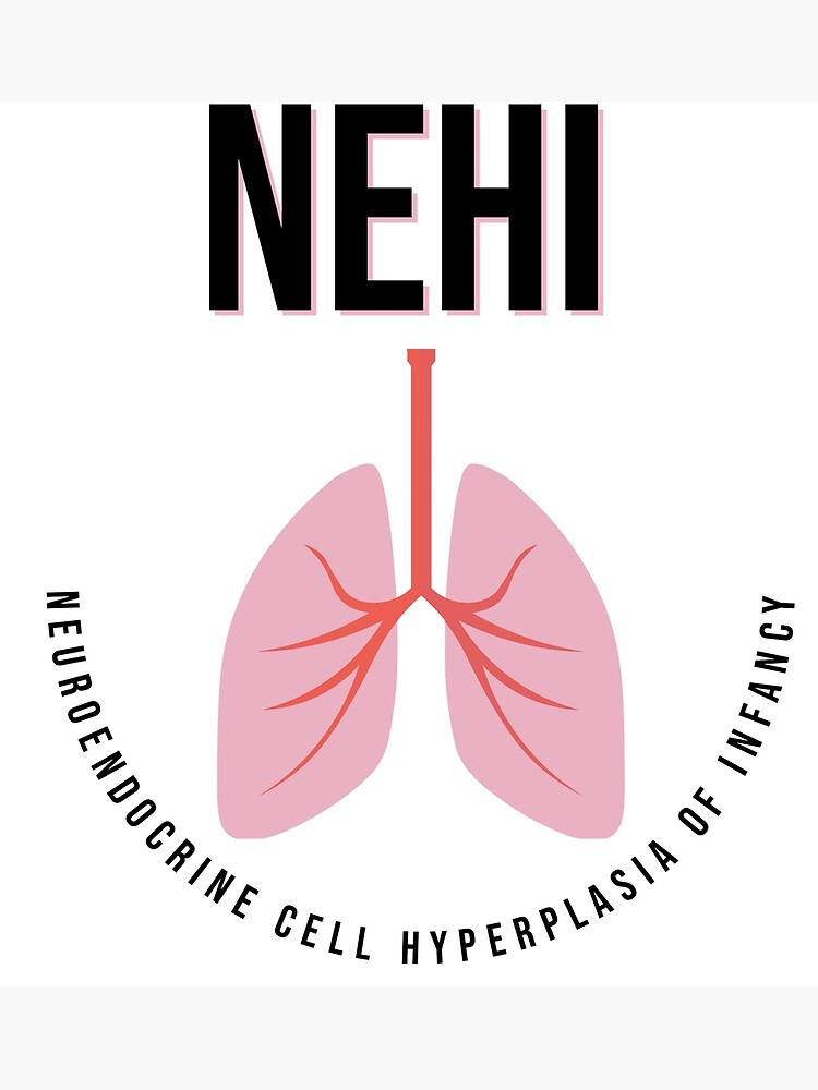 Lámina fotográfica «NEHI Hiperplasia de células neuroendocrinas de la ...