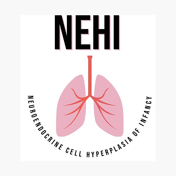 Lámina fotográfica «NEHI Hiperplasia de células neuroendocrinas de la ...