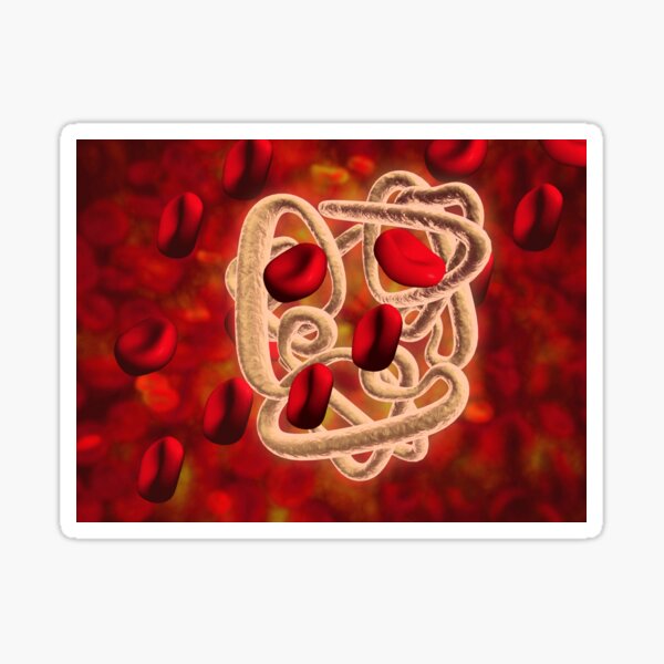 "Conceptual image of hemoglobin and red blood cells." Sticker for Sale ...