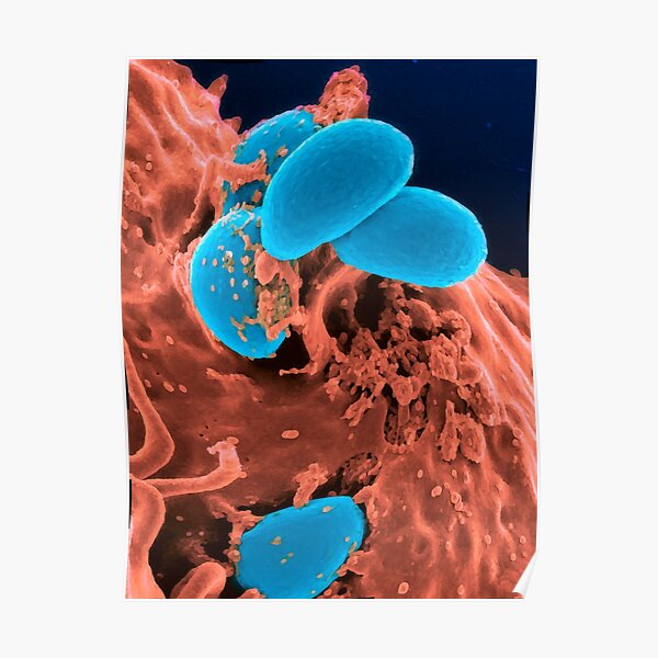 "Blue particles interaction with light brown liquid" Poster for Sale by ...