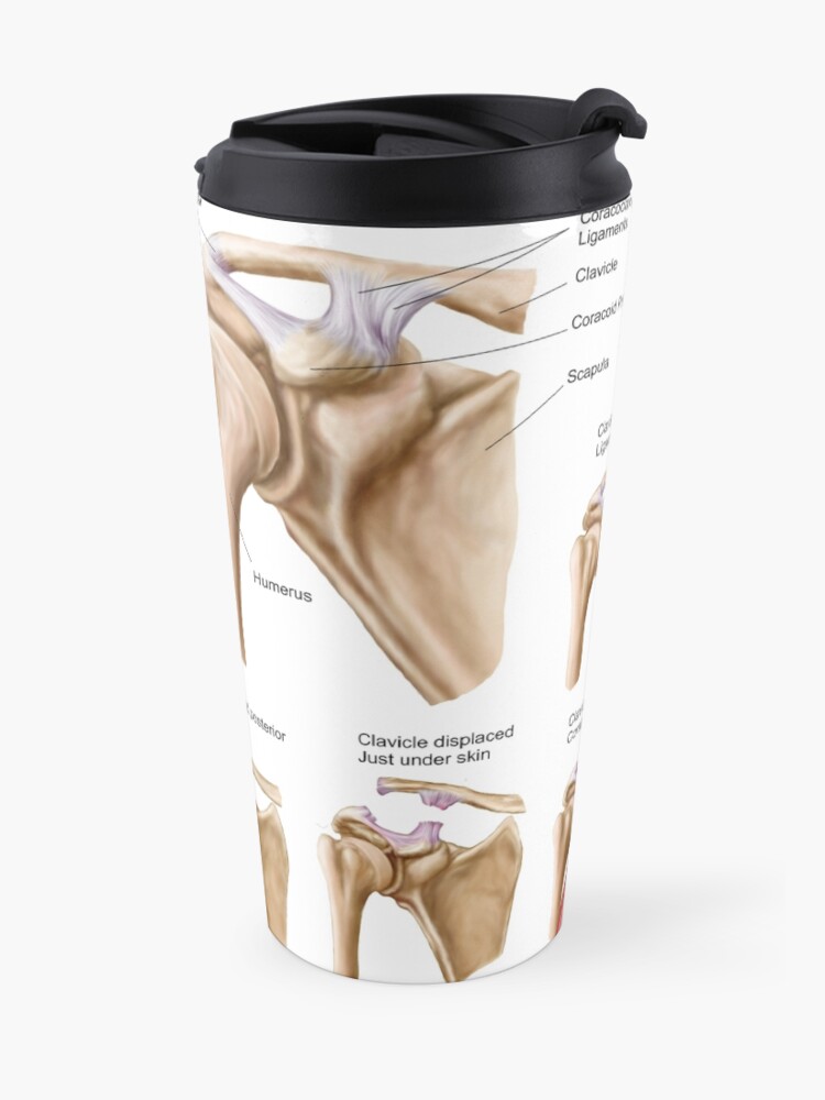 "Anatomy of acromioclavicular joint rupture and displacement." Travel ...