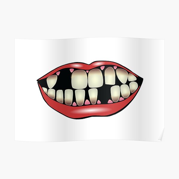 "Funny Missing Teeth men smile for smiling face Mask" Poster for Sale ...