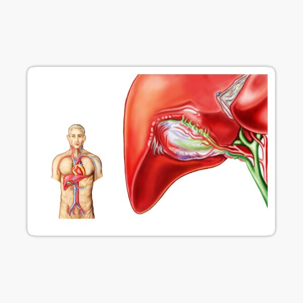 "Anatomy of gall bladder ganglion." Sticker for Sale by StocktrekImages ...