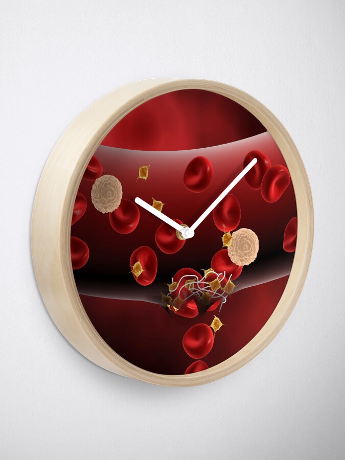 "Blood clotting inside artery." Clock for Sale by StocktrekImages ...