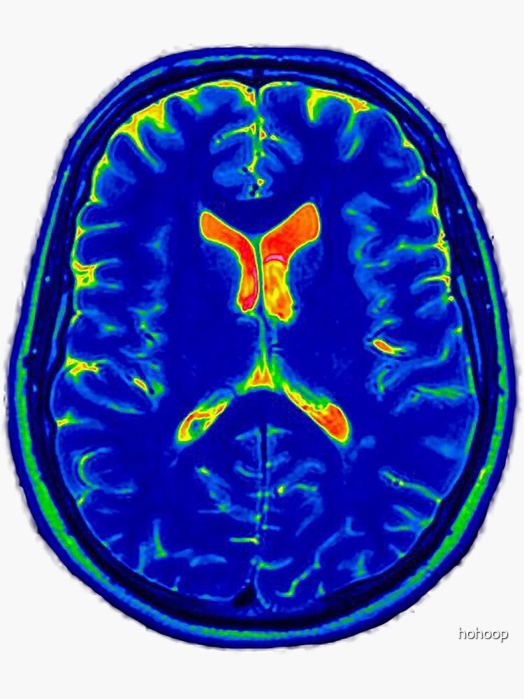 "Brain MRI Sticker color" Sticker for Sale by hohoop | Redbubble