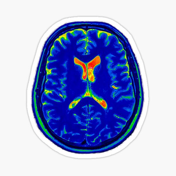 "Brain MRI Sticker color" Sticker for Sale by hohoop | Redbubble